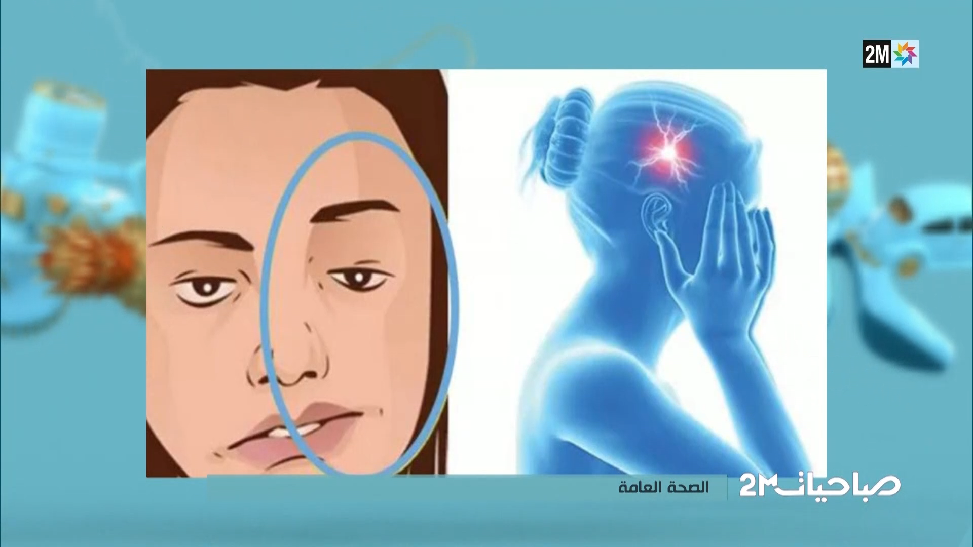 AVC: Asymétrie du visage, troubles de parole, engourdissements… les ...